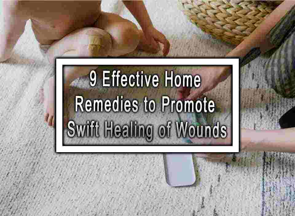 9 Effective Home Remedies to Promote Swift Healing of Wounds